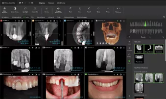 DTX Studio Clinic | DTX Studio suite